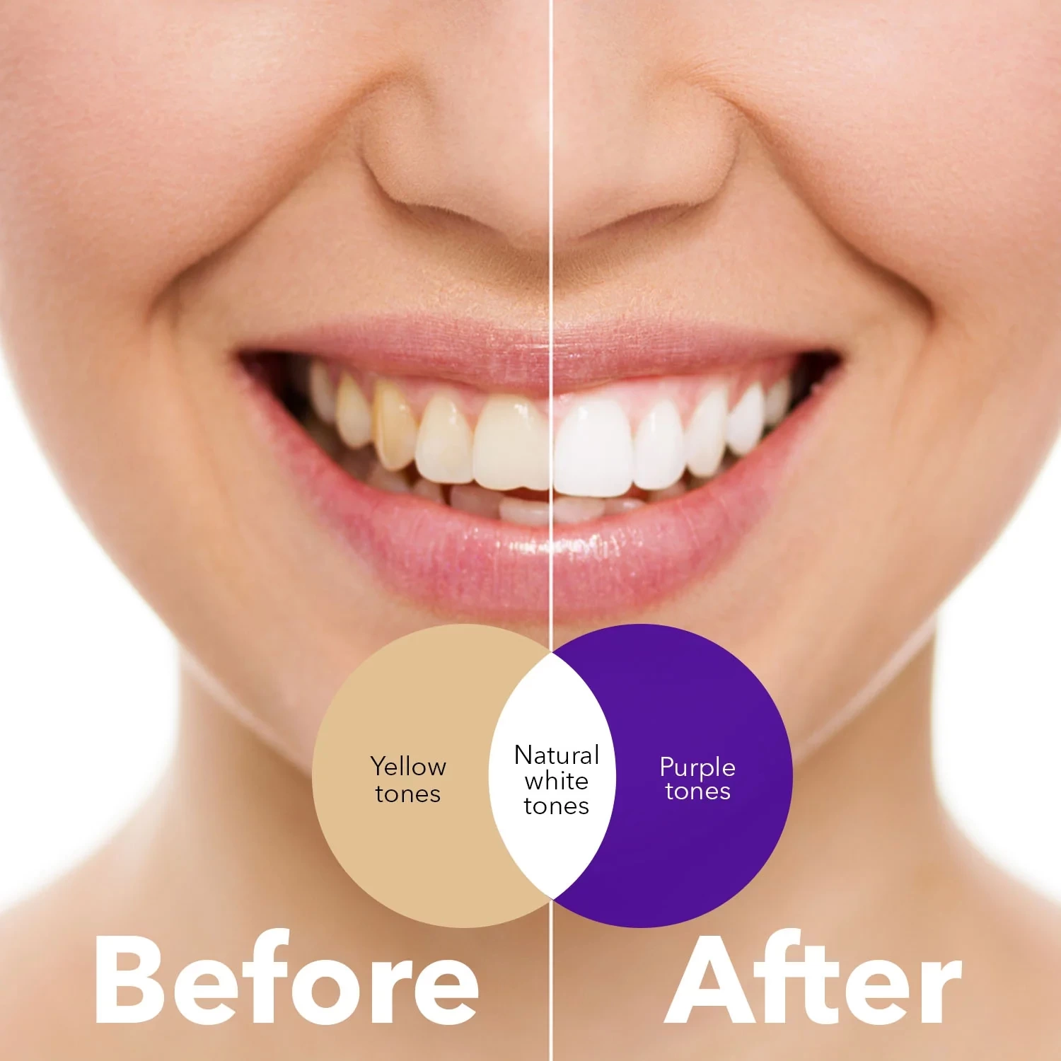 Smilekit V34 Color Corrector Toothpaste | LitUpSmile